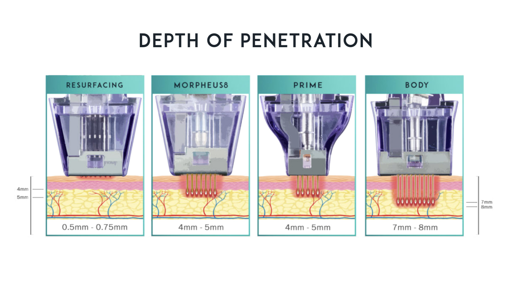 7 Morpheus8 benefits - Hush LA Medspa