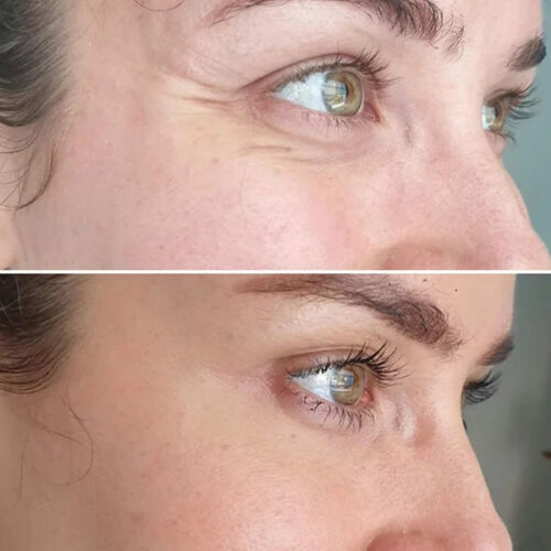From Frosty to Sunny: The Seasonal Facial Routine Guide - Hush LA Medspa