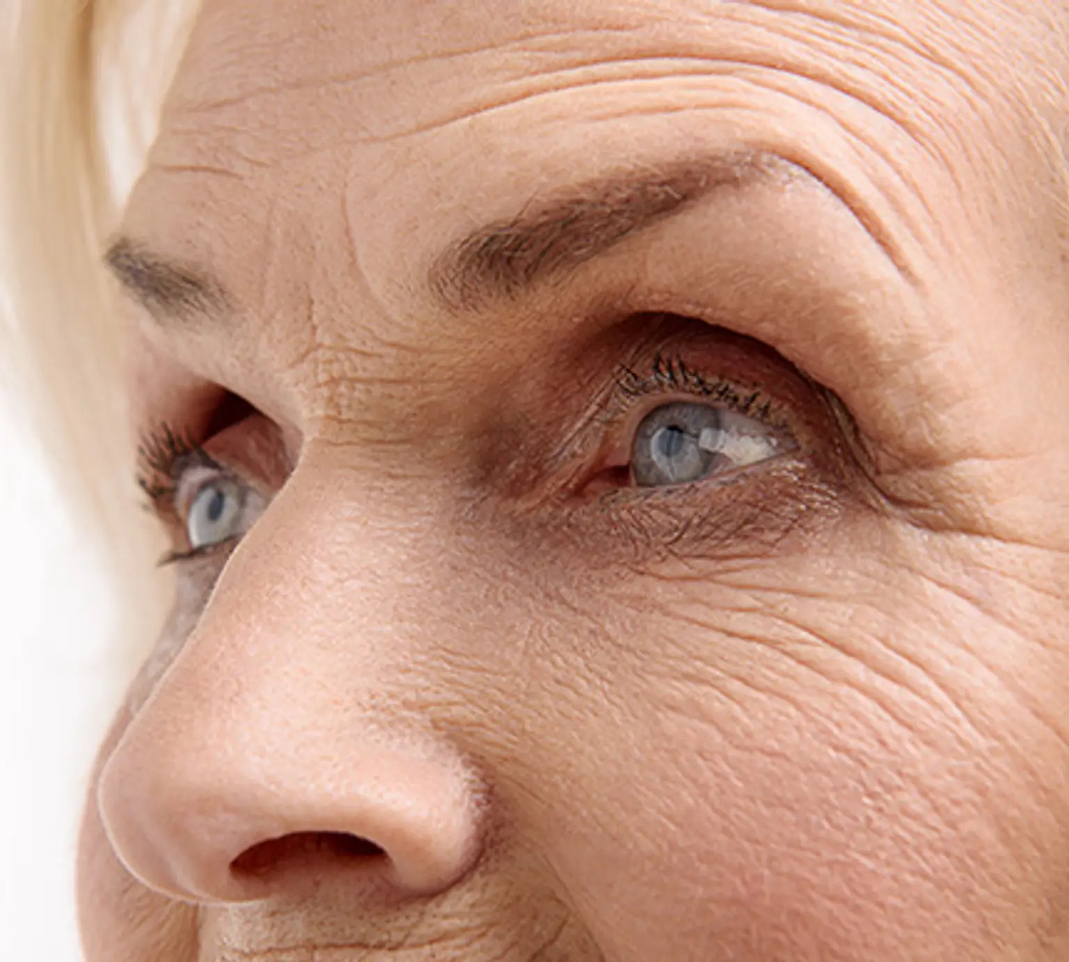 Best professional treatments for reducing crepey skin - Hush LA Medspa