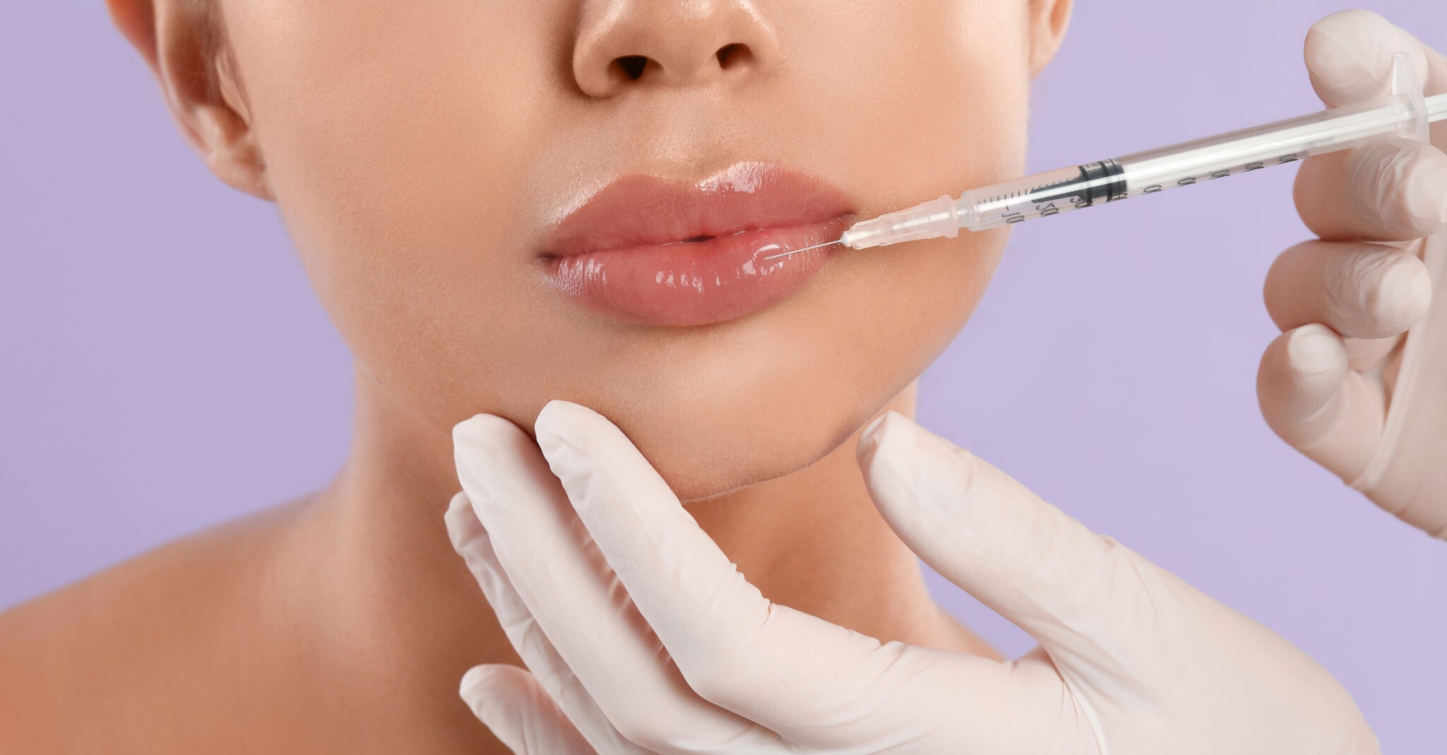 What You Need to Know About Lip Fillers | Hush LA Medspa